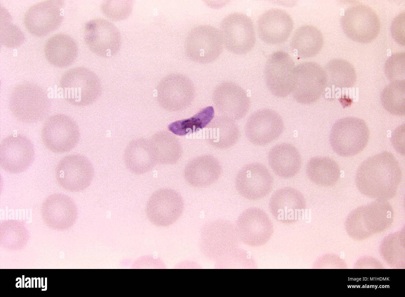 Plasmodium Falciparum Microgametocyte