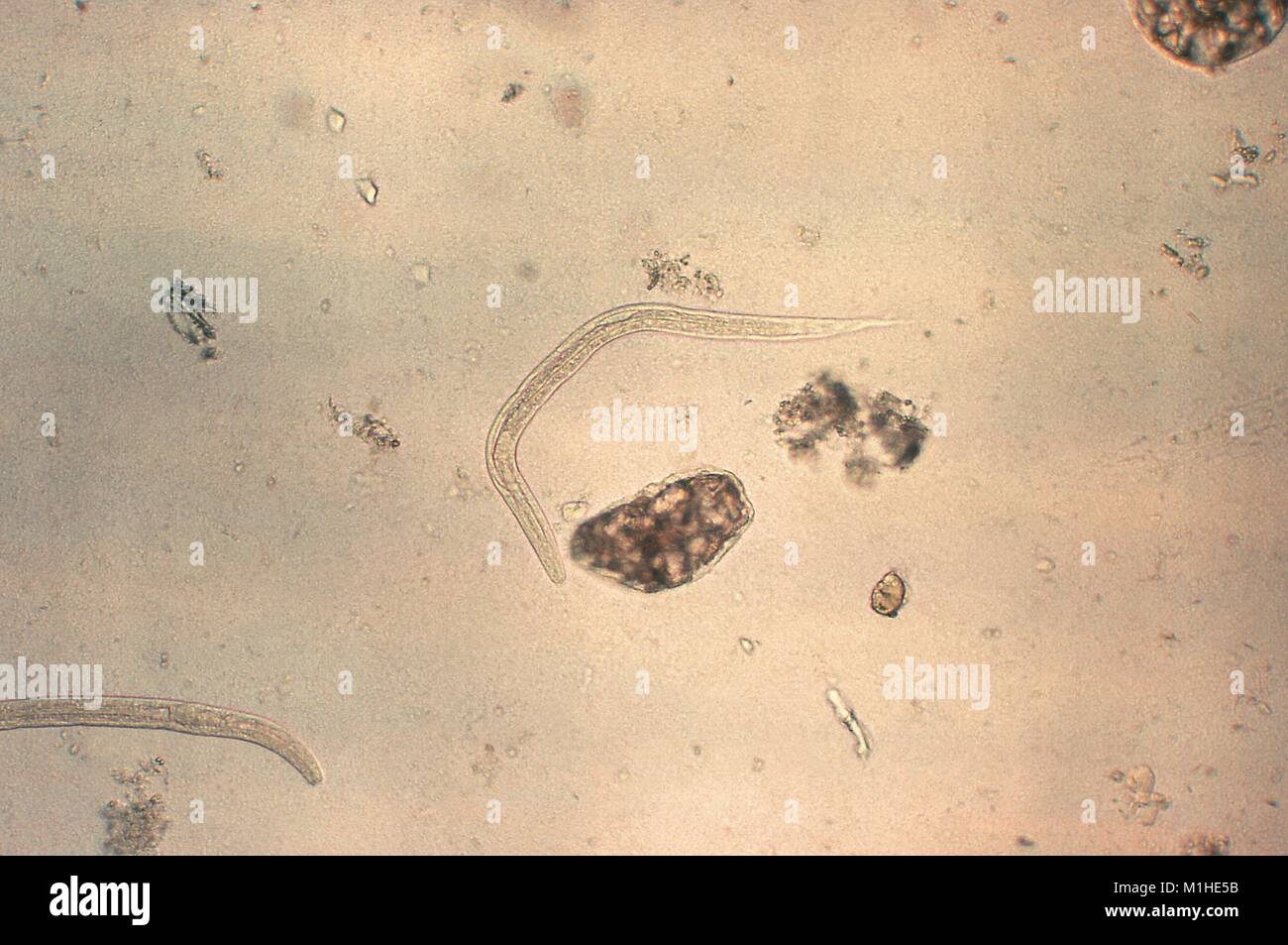 Strongyloides High Resolution Stock Photography and Images - Alamy