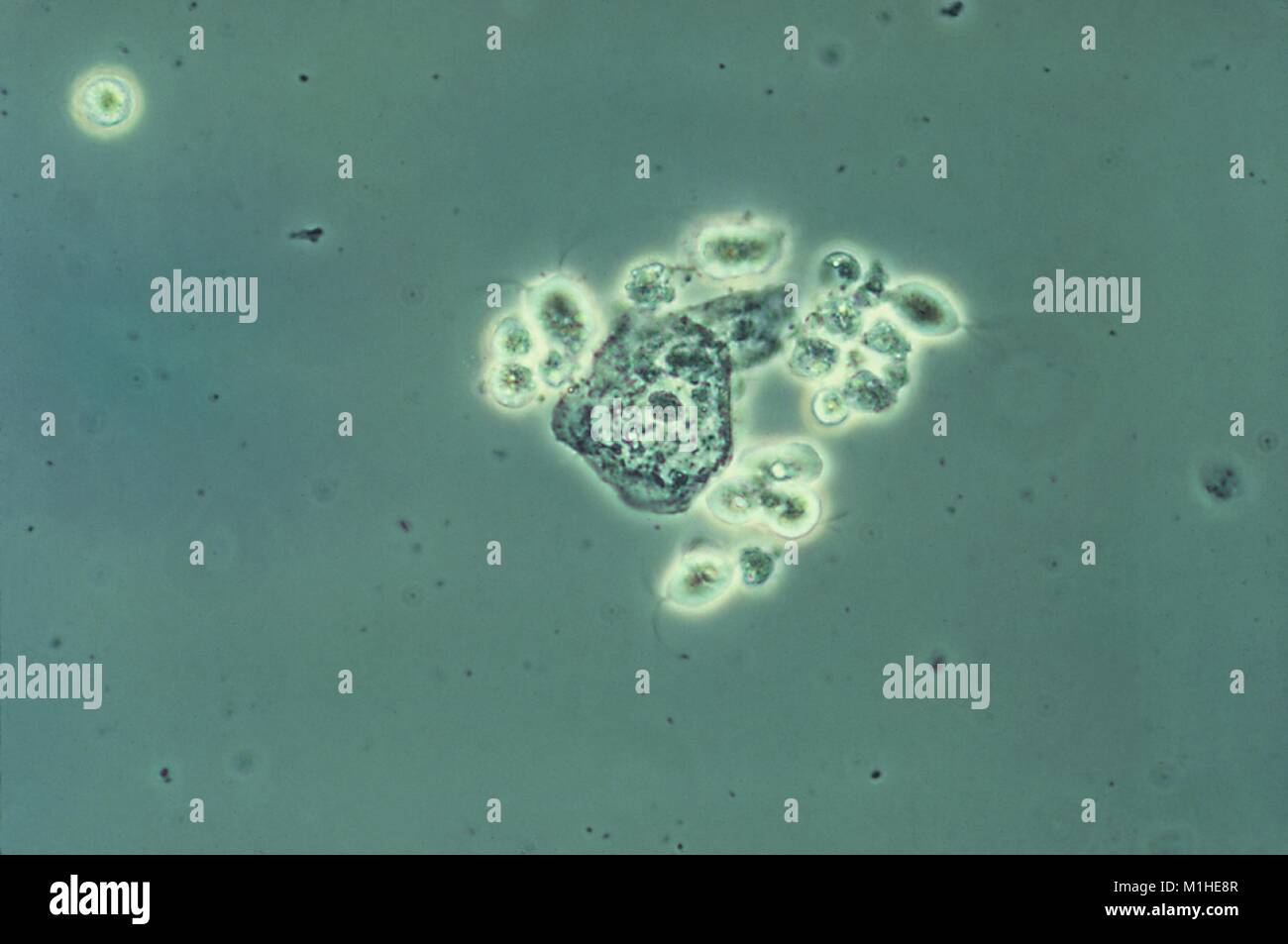 Trichomonas hi-res stock photography and images - Alamy