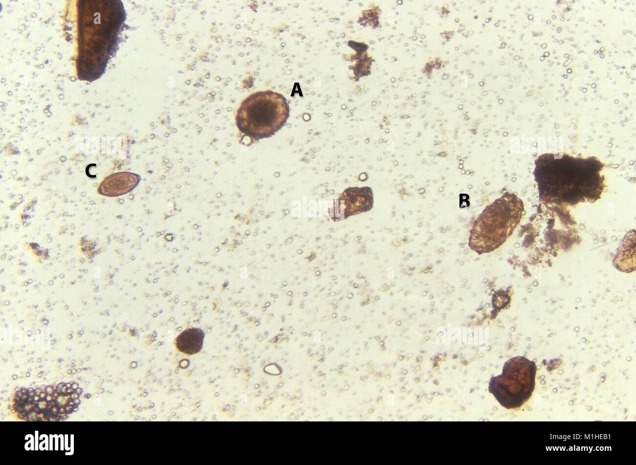 Trichuris and Ascaris fertilized and unfertilized eggs revealed in the ...