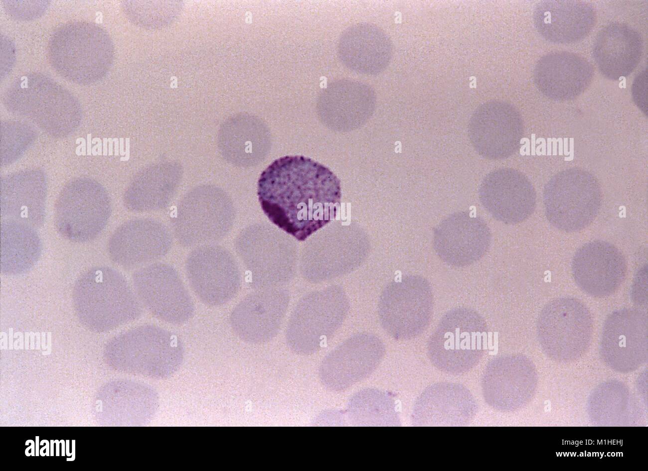 Plasmodium Vivax Images