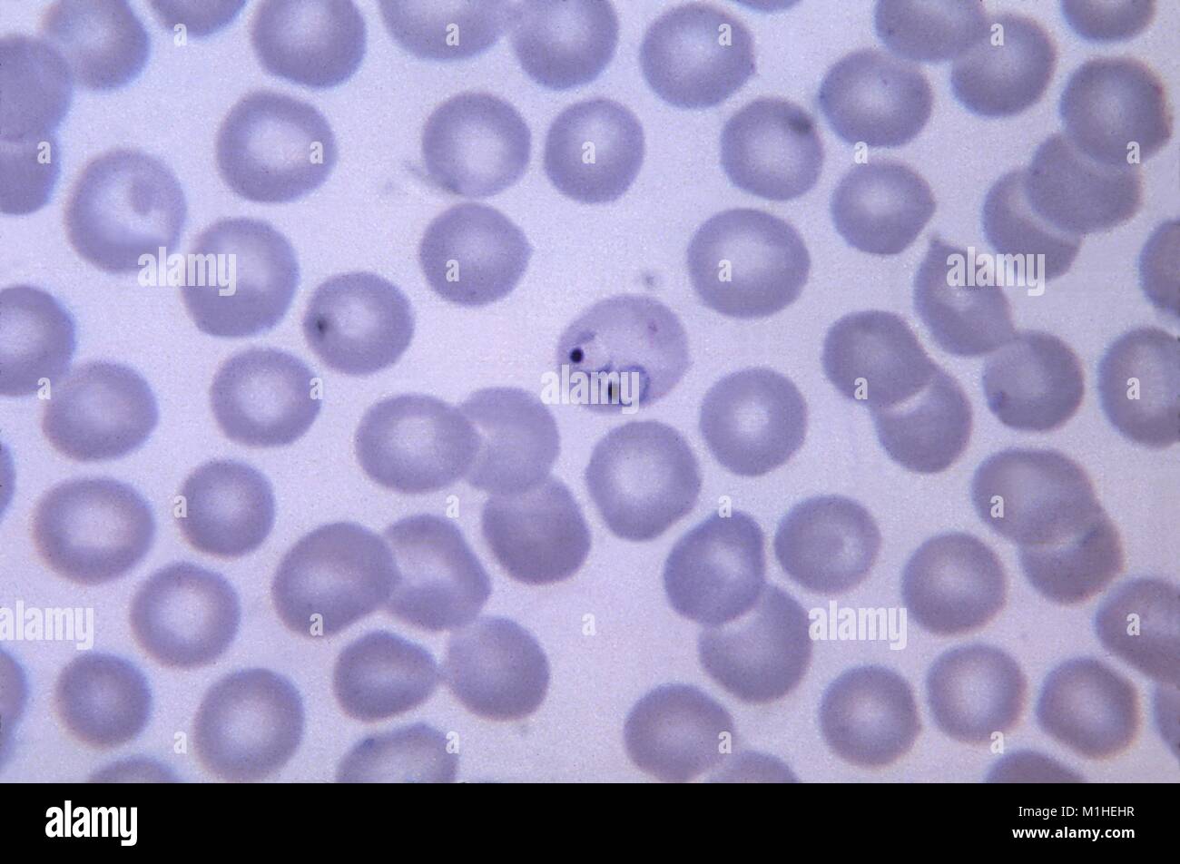 Photomicrograph blood smear hi-res stock photography and images - Alamy