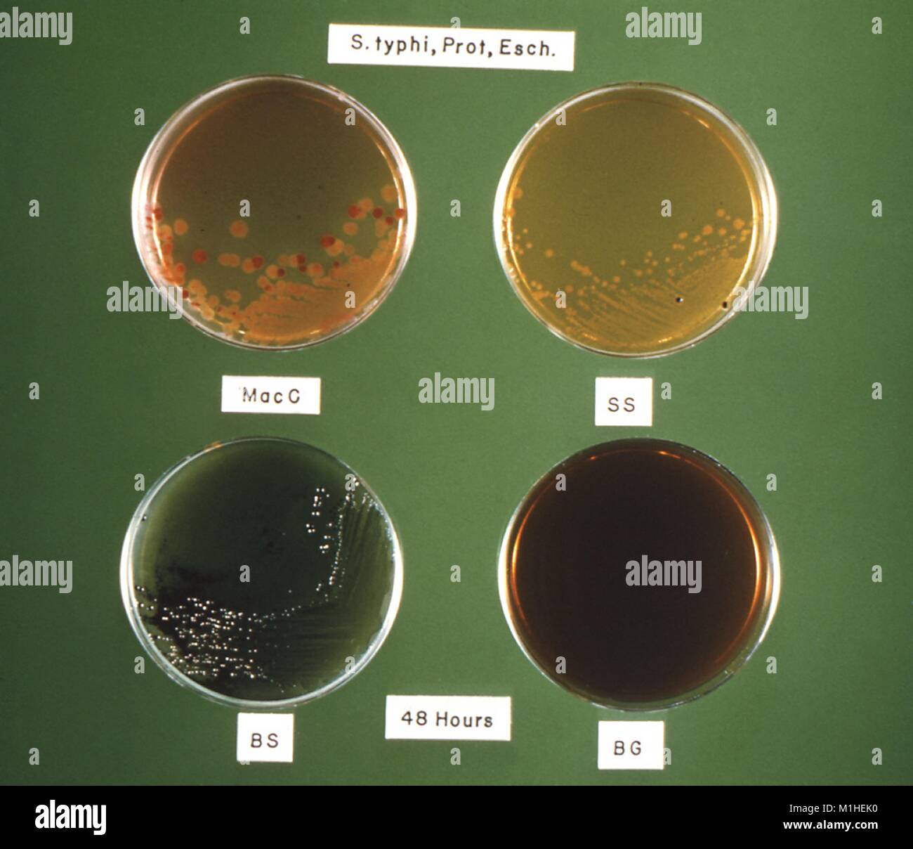 Photograph of four Petri dishes with the same bacteria (S. typhi, E ...