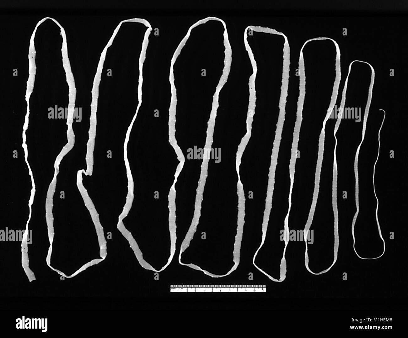 Taenia tapeworm Black and White Stock Photos & Images - Alamy