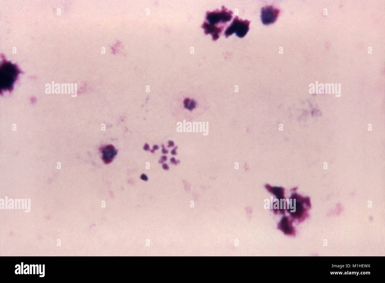 Photomicrograph of malaria hi-res stock photography and images - Alamy