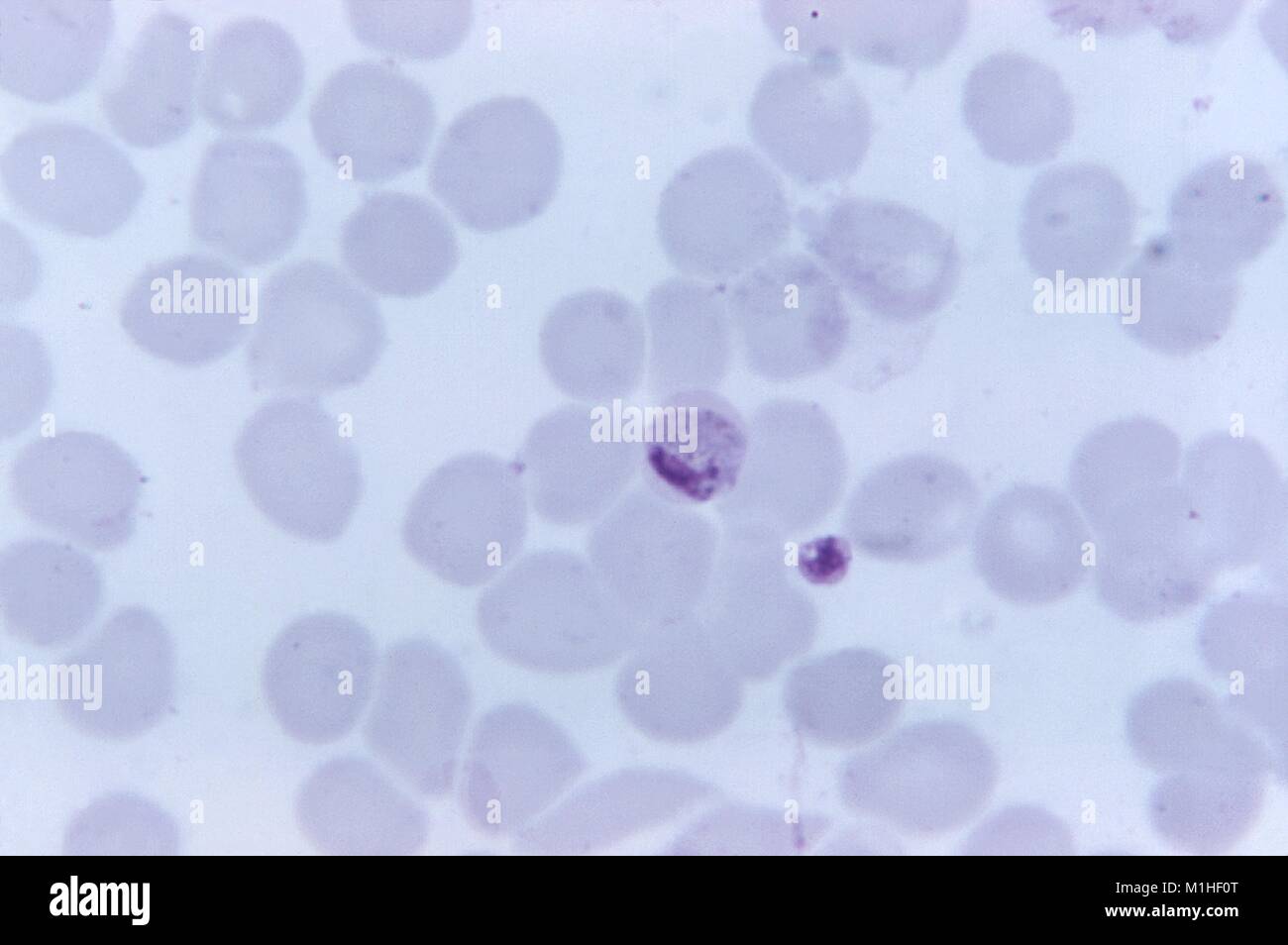 Plasmodium Slide Labeled