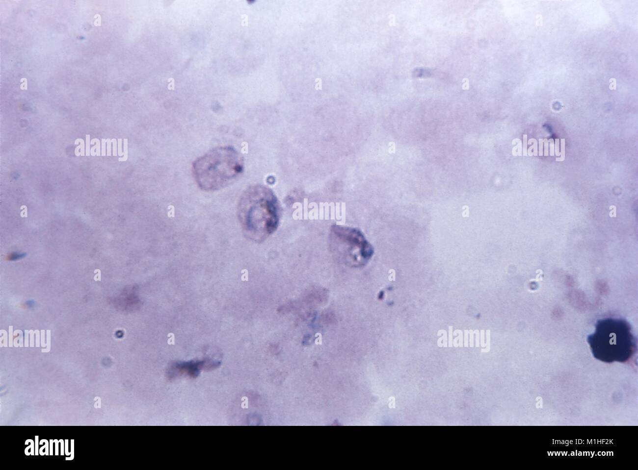 Schuffner hi-res stock photography and images - Alamy