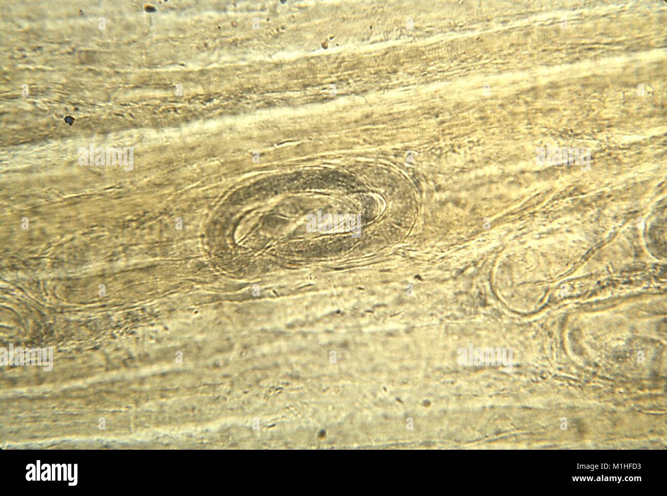 Microphotograph of a Trichinella cyst, indicating the presence of ...