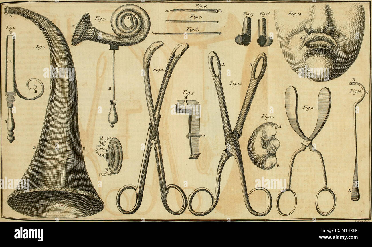 A general system of surgery in three parts - Containing the doctrine ...