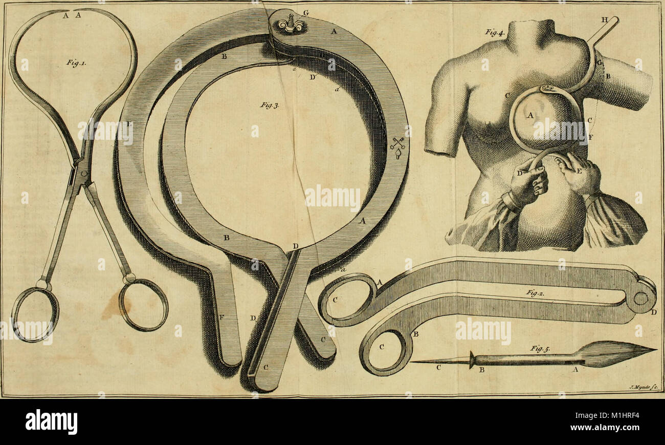 A general system of surgery in three parts - Containing the doctrine ...