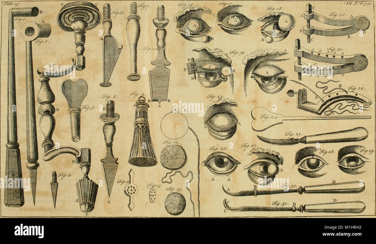 A general system of surgery in three parts - Containing the doctrine ...