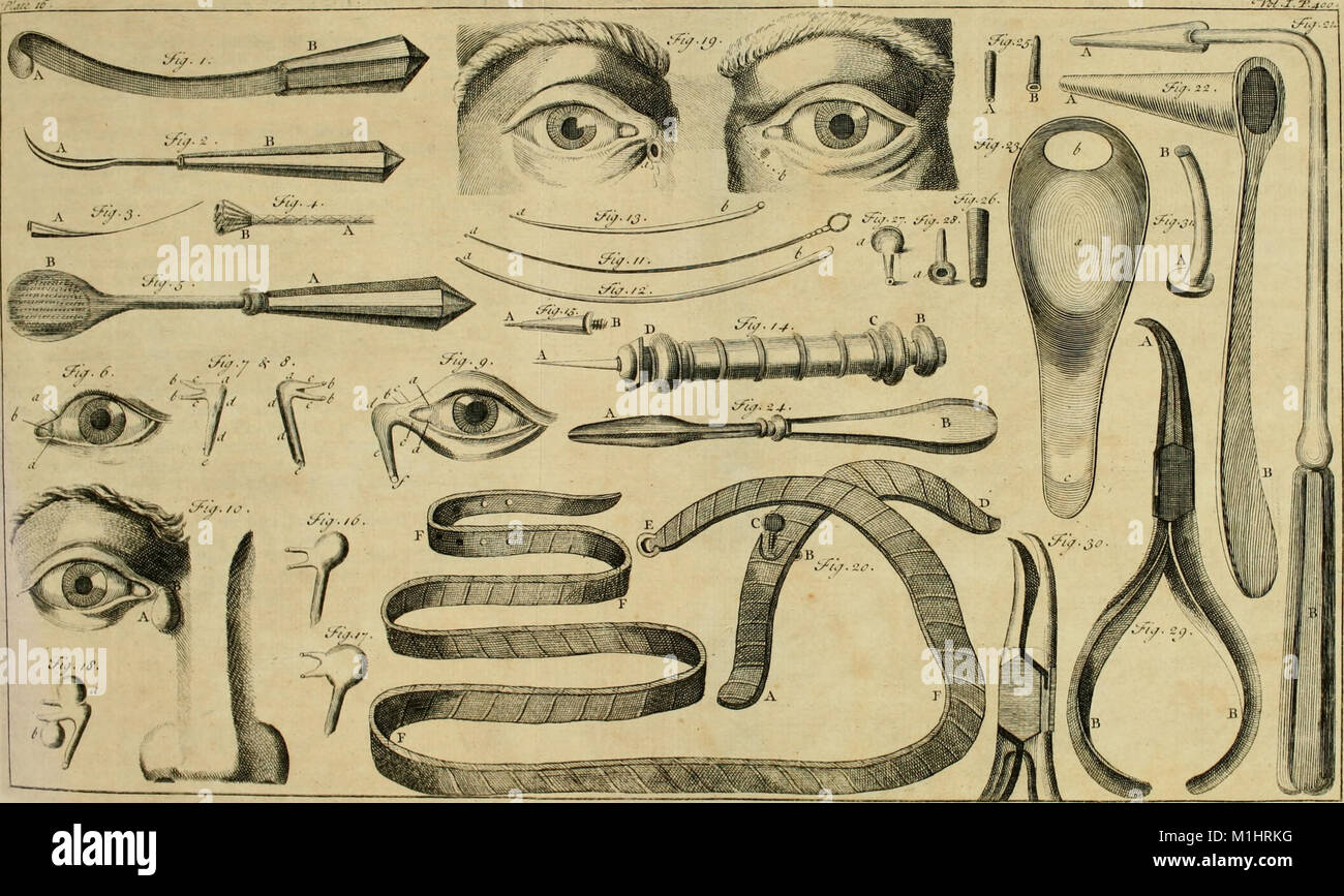 A general system of surgery in three parts - Containing the doctrine ...