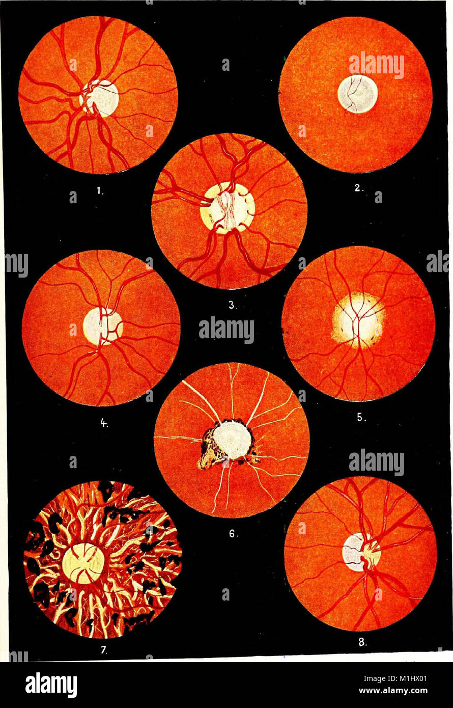 'A Treatise on Diagnostic Methods of Examination' (1909) discusses ...