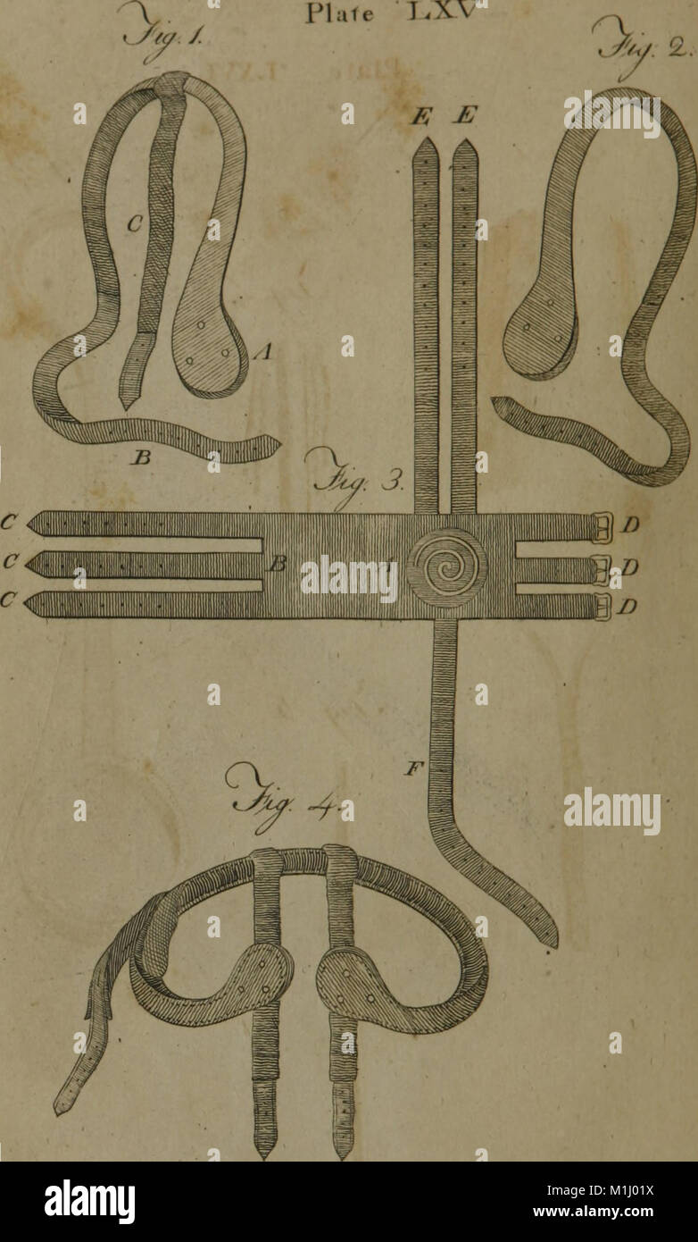 This 1804 volume of 'A System of Surgery' provides surgical techniques ...