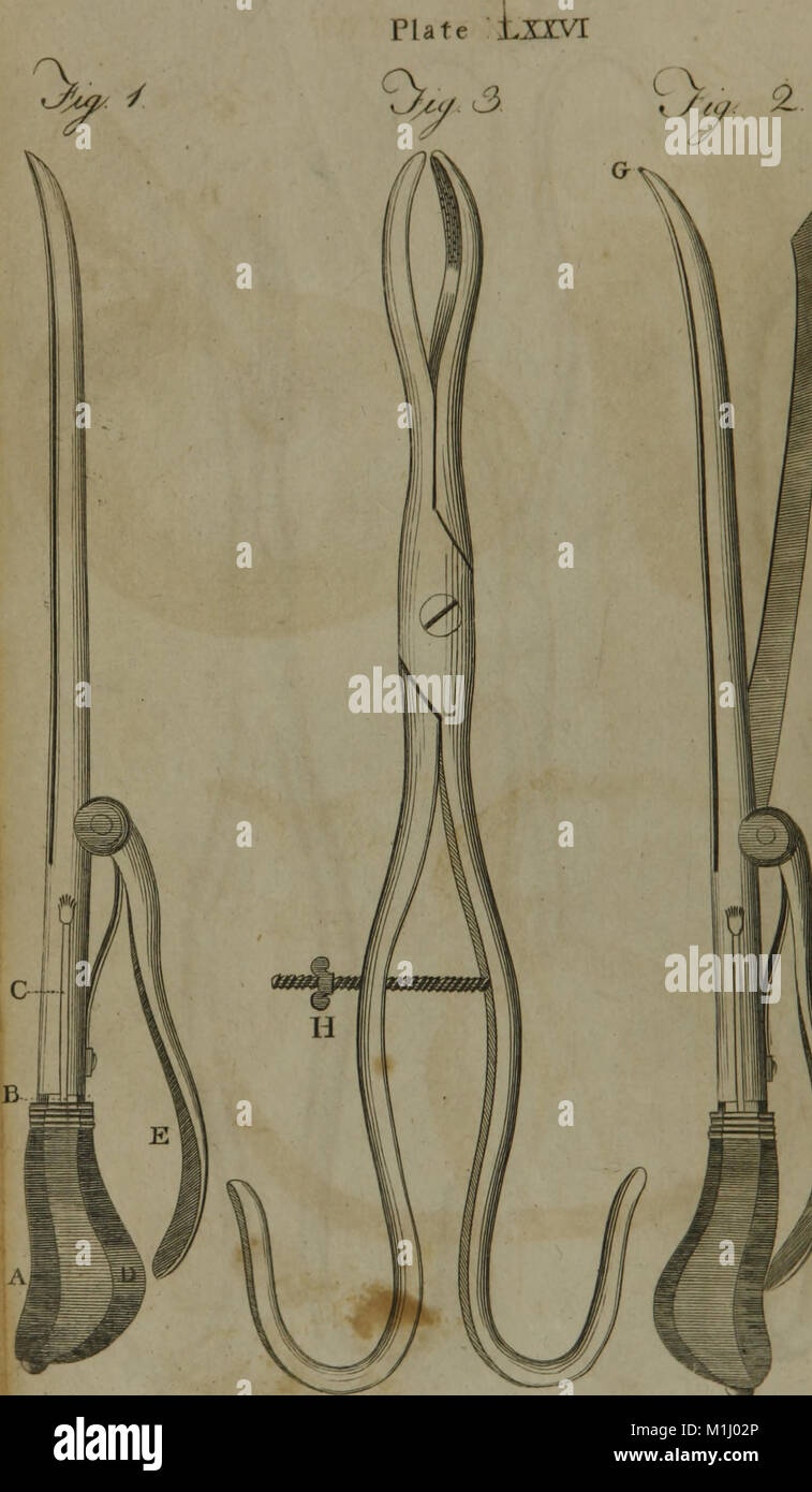 This 1804 volume of *A System of Surgery* covers advanced surgical ...