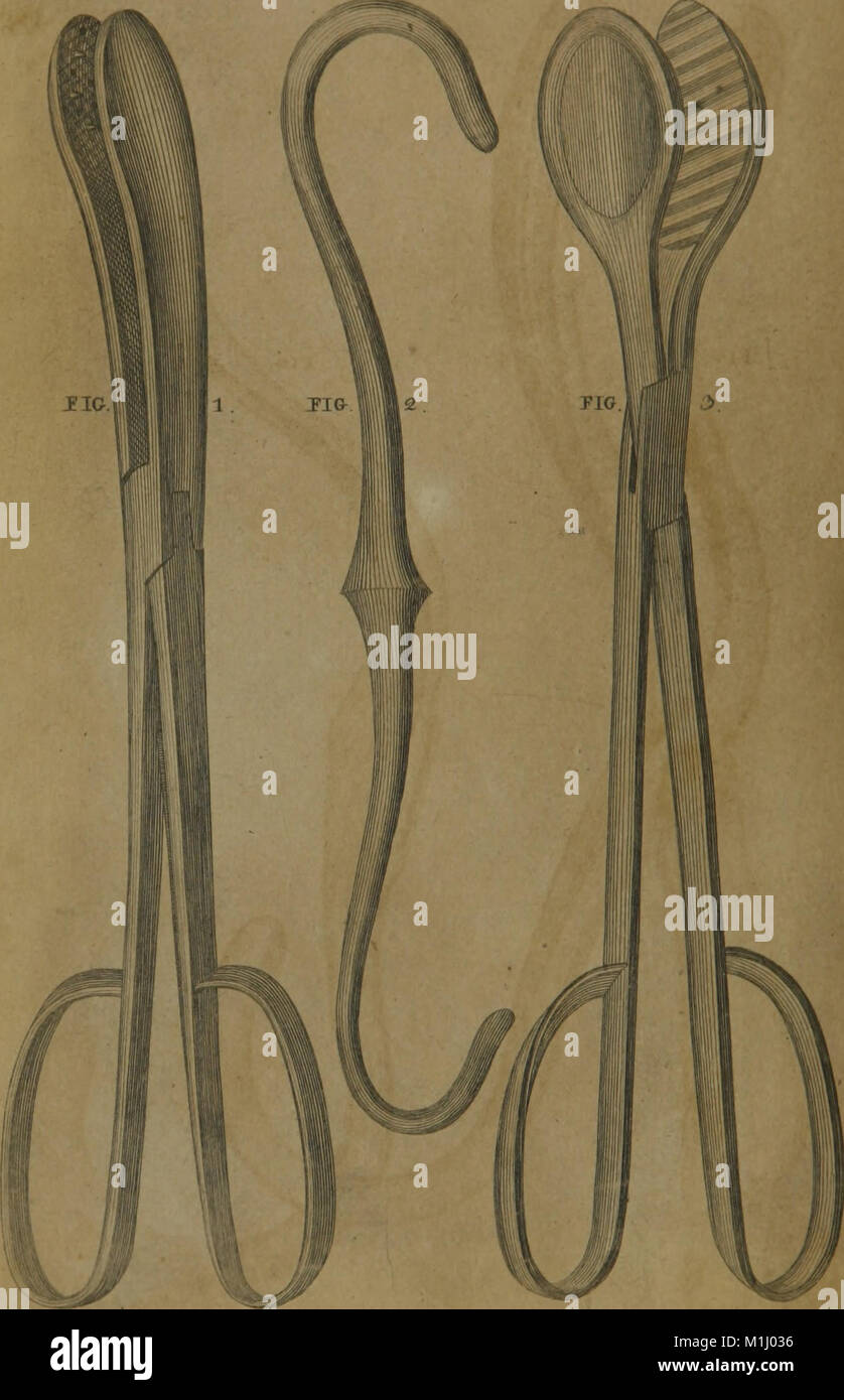 Volume 4 of 'A System of Surgery' from 1804 discusses advanced surgical ...