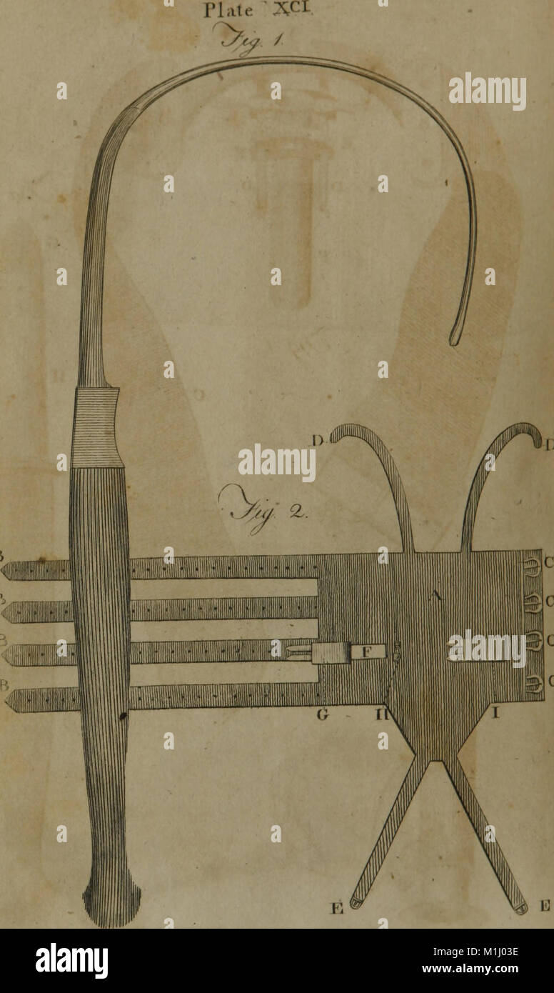 The fourth volume of 'A System of Surgery' (1804) presents detailed ...