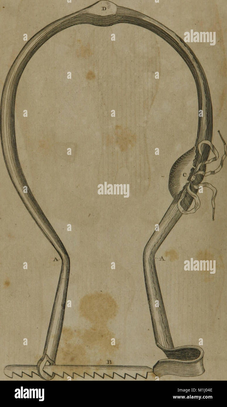 Volume 4 of 'A System of Surgery' (1804) provides detailed accounts of ...