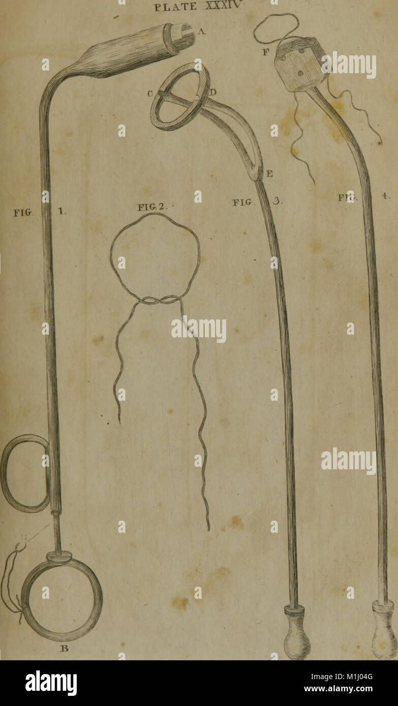 *A System of Surgery* (1804), Volume 4, covers the techniques and ...