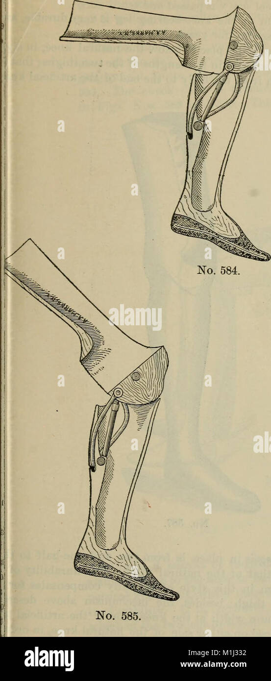 This 1901 treatise focuses on the design and use of artificial limbs ...