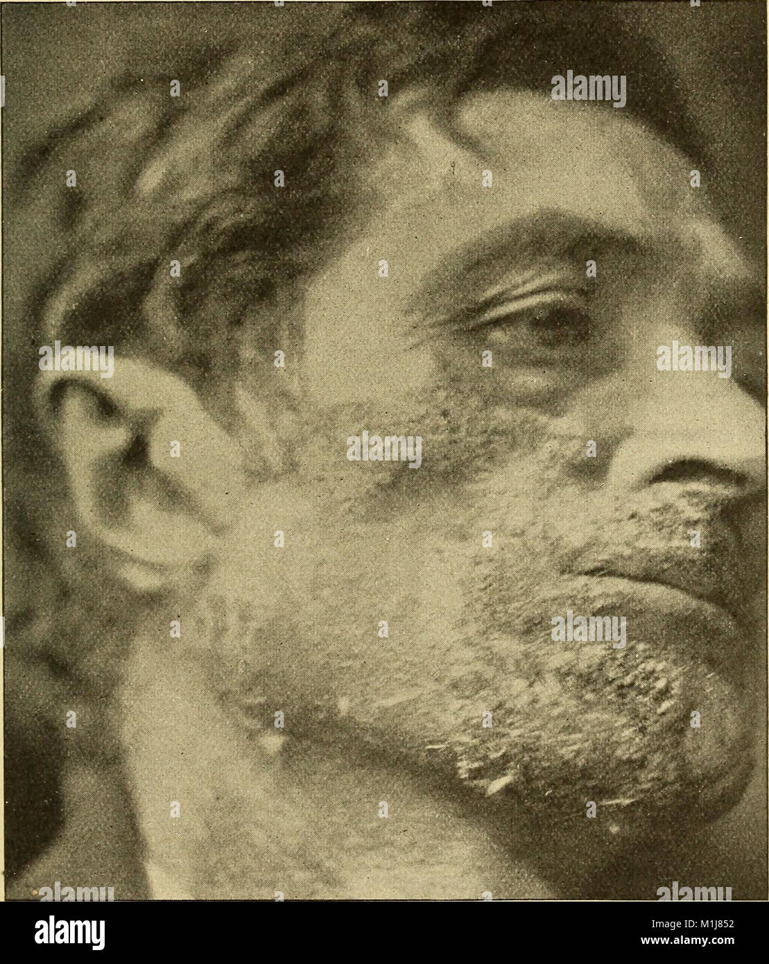 This 1897 treatise provides an in-depth study of skin diseases, aimed ...