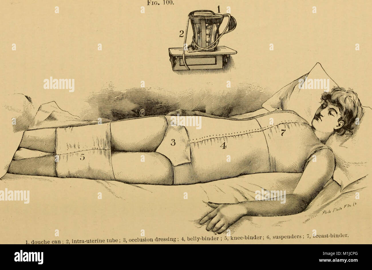 A system of obstetrics (1888) (14769263664 Stock Photo - Alamy