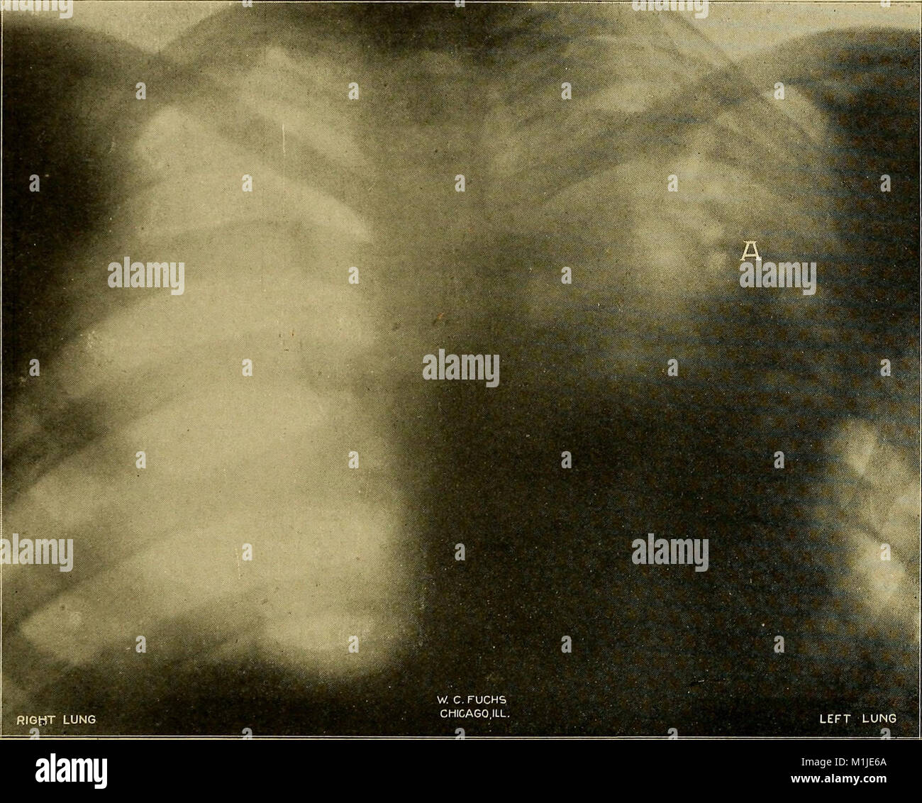 A system of instruction in X-ray methods and medical uses of light, hot ...