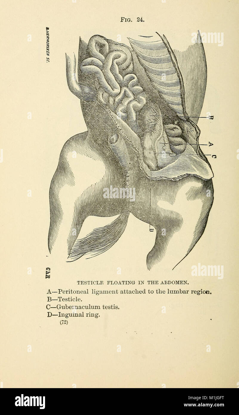 'Animal Castration' (1902) focuses on the surgical procedure of ...