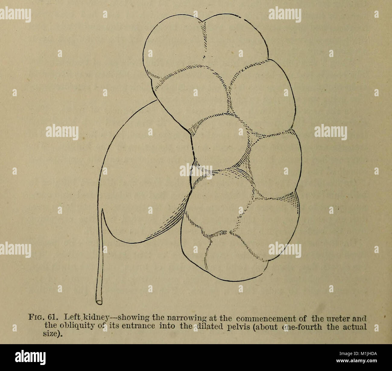 A practical treatise on urinary and renal diseases - including urinary ...