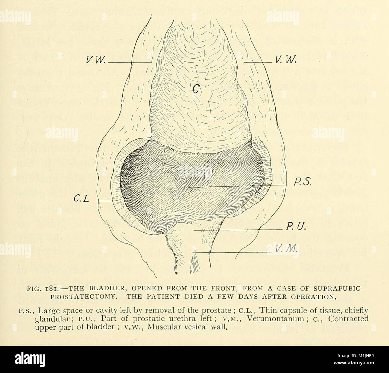 The 1910 'Manual of Operative Surgery' provides in-depth guidance on ...
