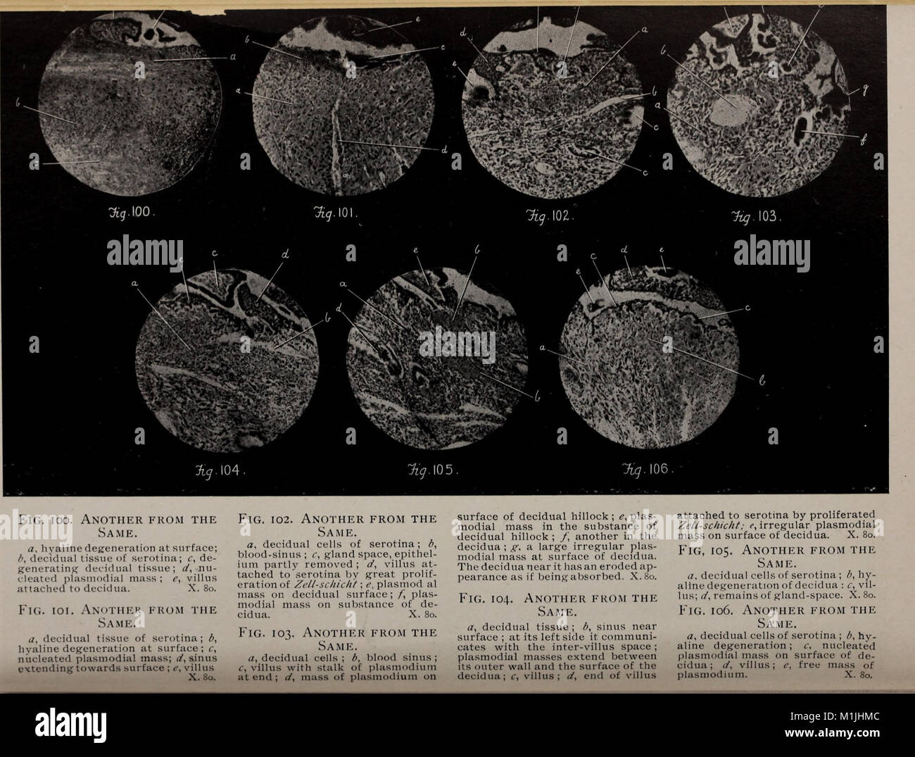 The American Gynaecological and Obstetrical Journal, published in 1897 ...