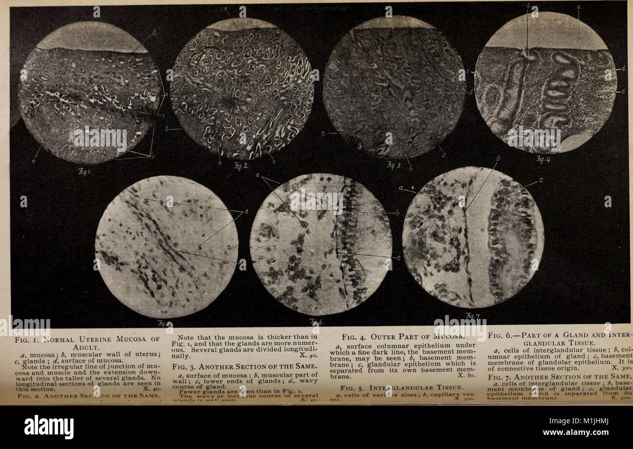The 'American Gynaecological and Obstetrical Journal' (1897) is a ...