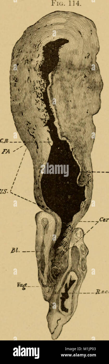 A system of obstetrics (1888) (14771635655 Stock Photo - Alamy