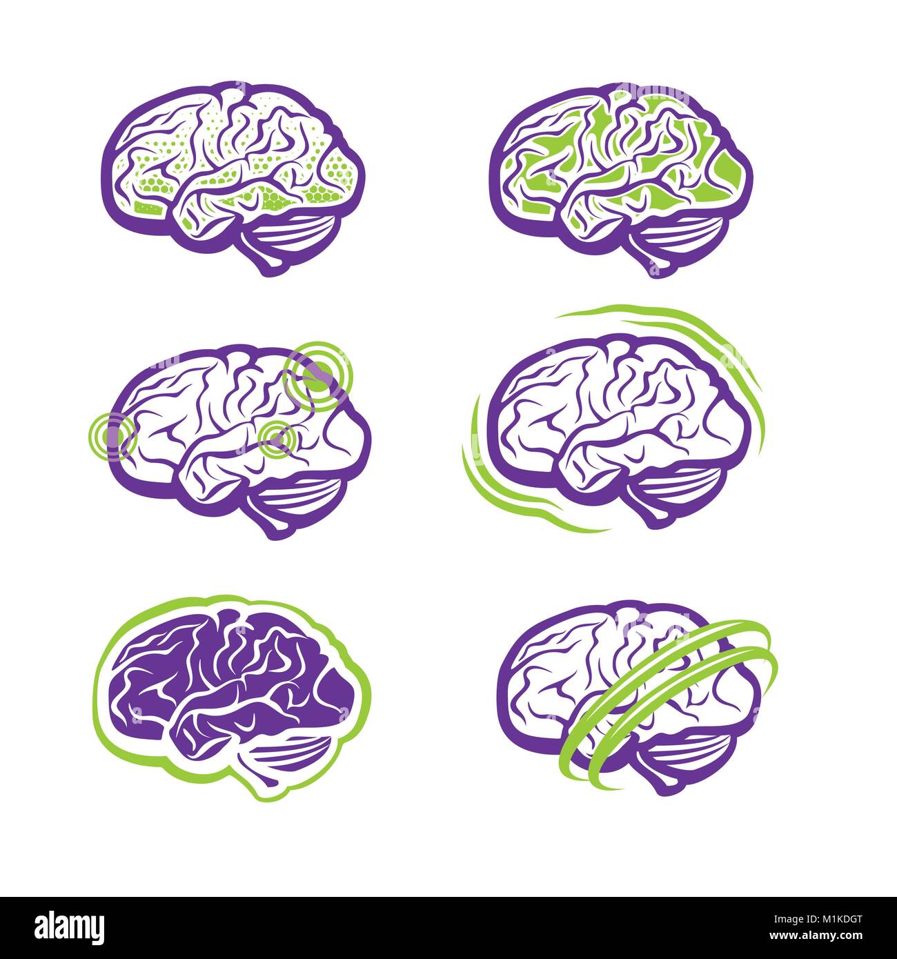 All about brain - brain diseases and treatment Stock Vector Image & Art ...