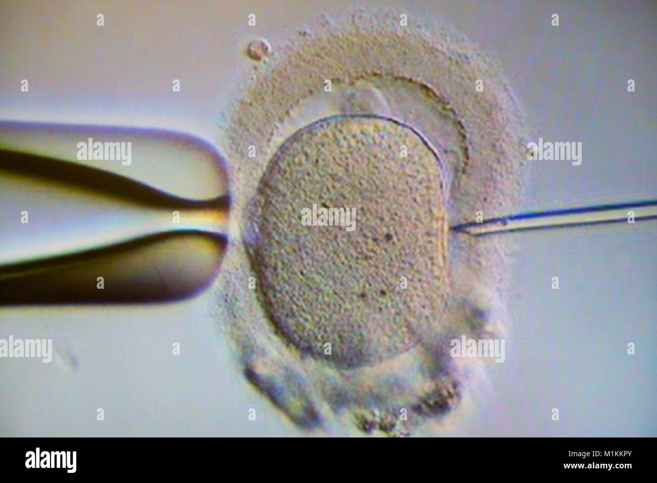 Intracytoplasmic sperm injection icsi hi-res stock photography and ...