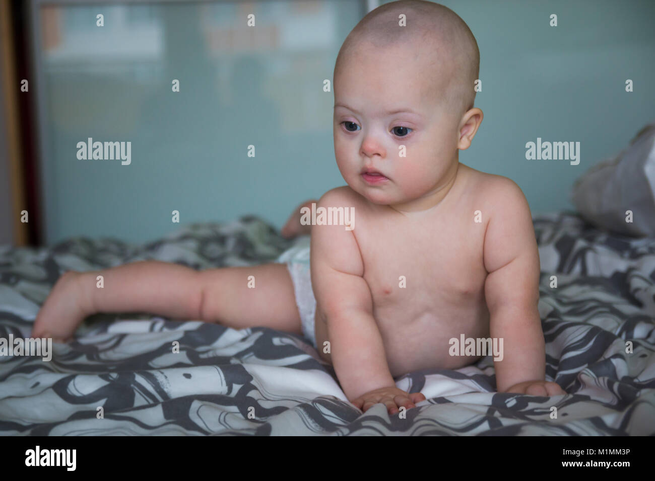 portrait-of-cute-baby-boy-with-down-syndrome-stock-photo-alamy
