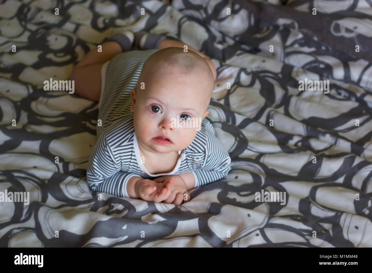 Portrait of cute baby boy with Down syndrome Stock Photo - Alamy