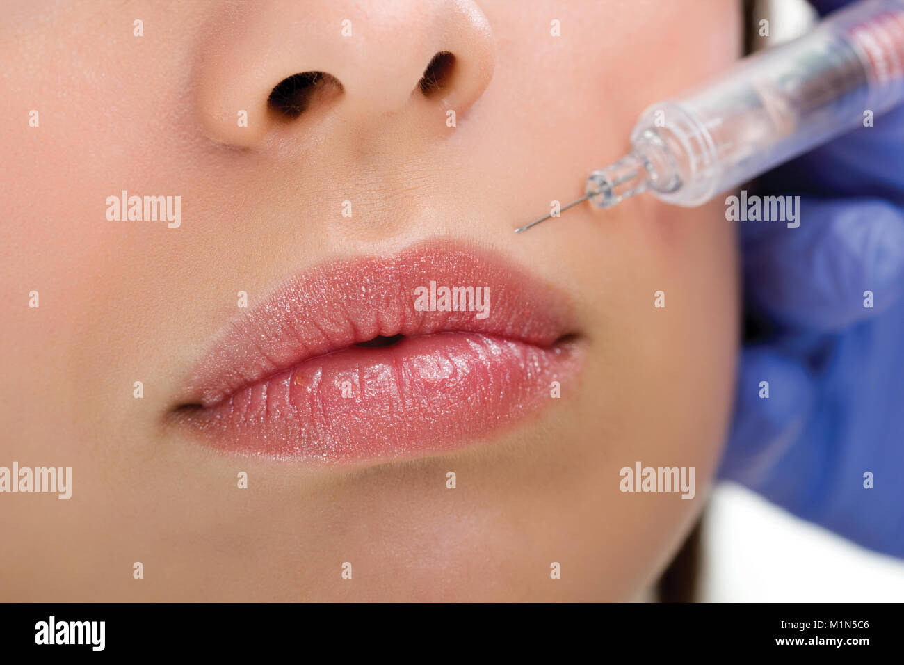 Botox shot in the female cheek,close up Stock Photo - Alamy
