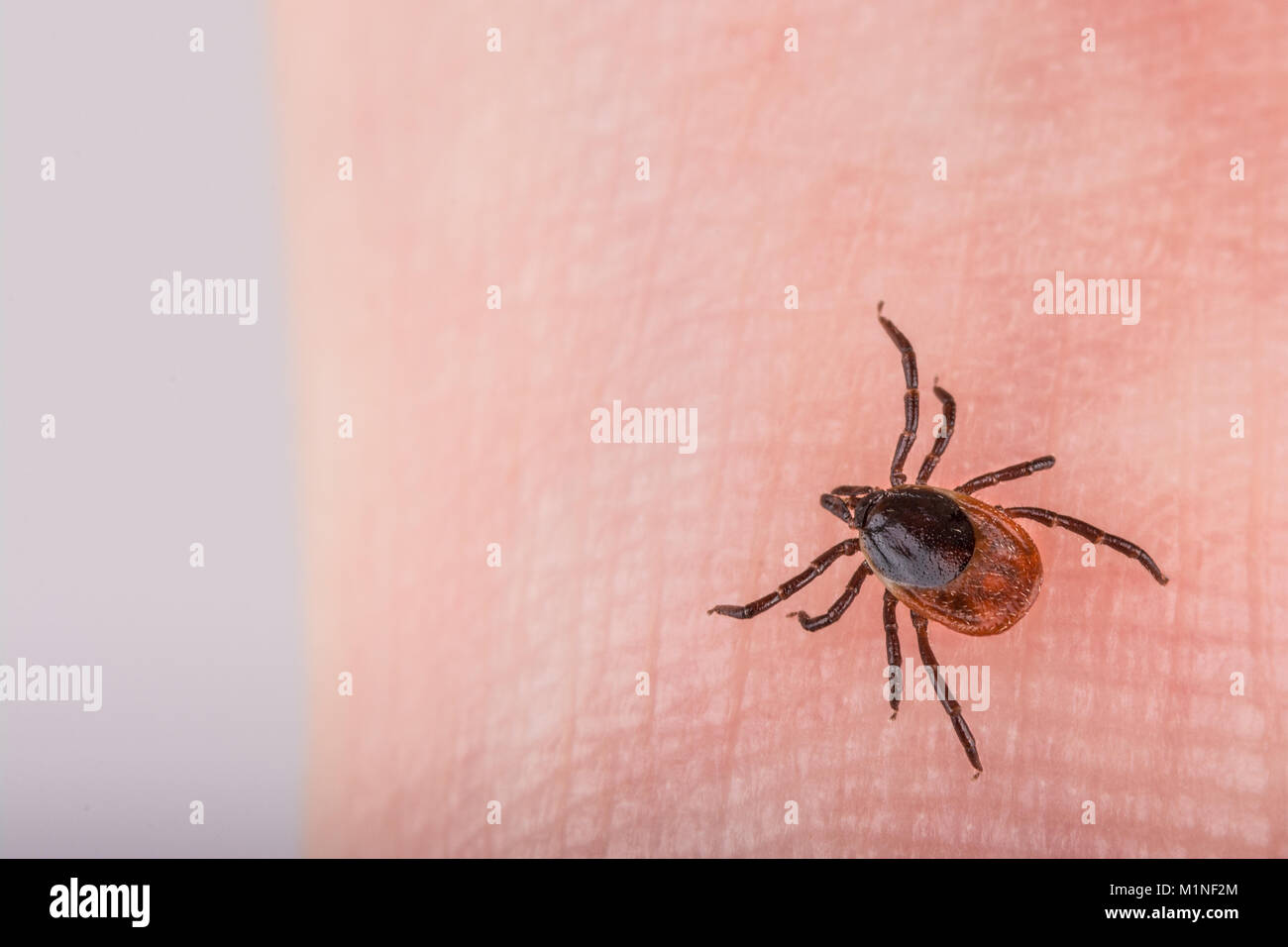 Close-up of castor bean tick on a human finger skin. Ixodes ricinus ...