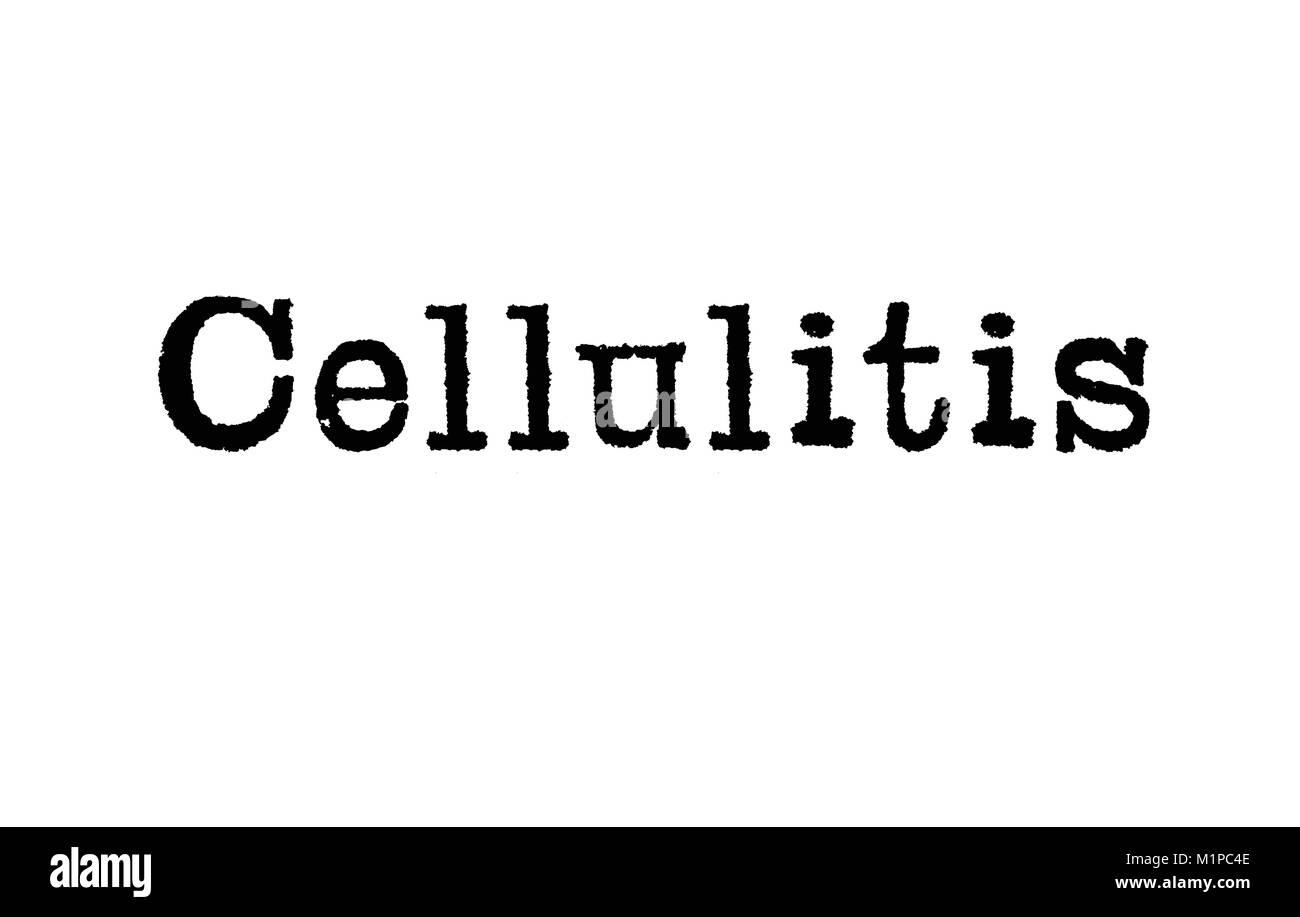 Cellulitis skin Black and White Stock Photos & Images - Alamy