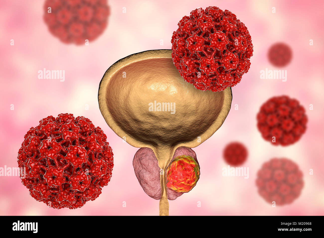 Viral etiology of prostate cancer. Conceptual illustration showing ...