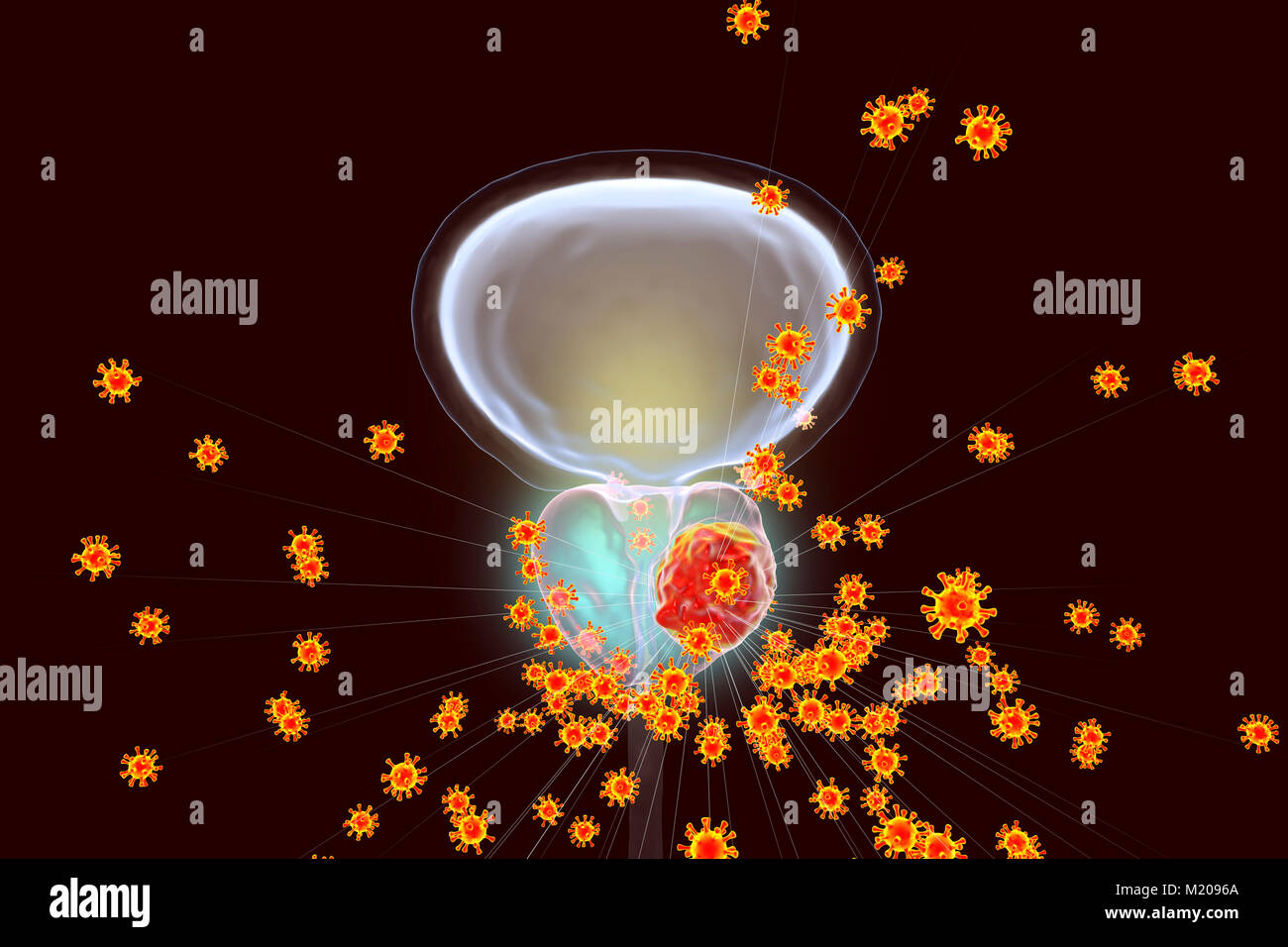 Viral etiology of prostate cancer. Conceptual illustration showing ...