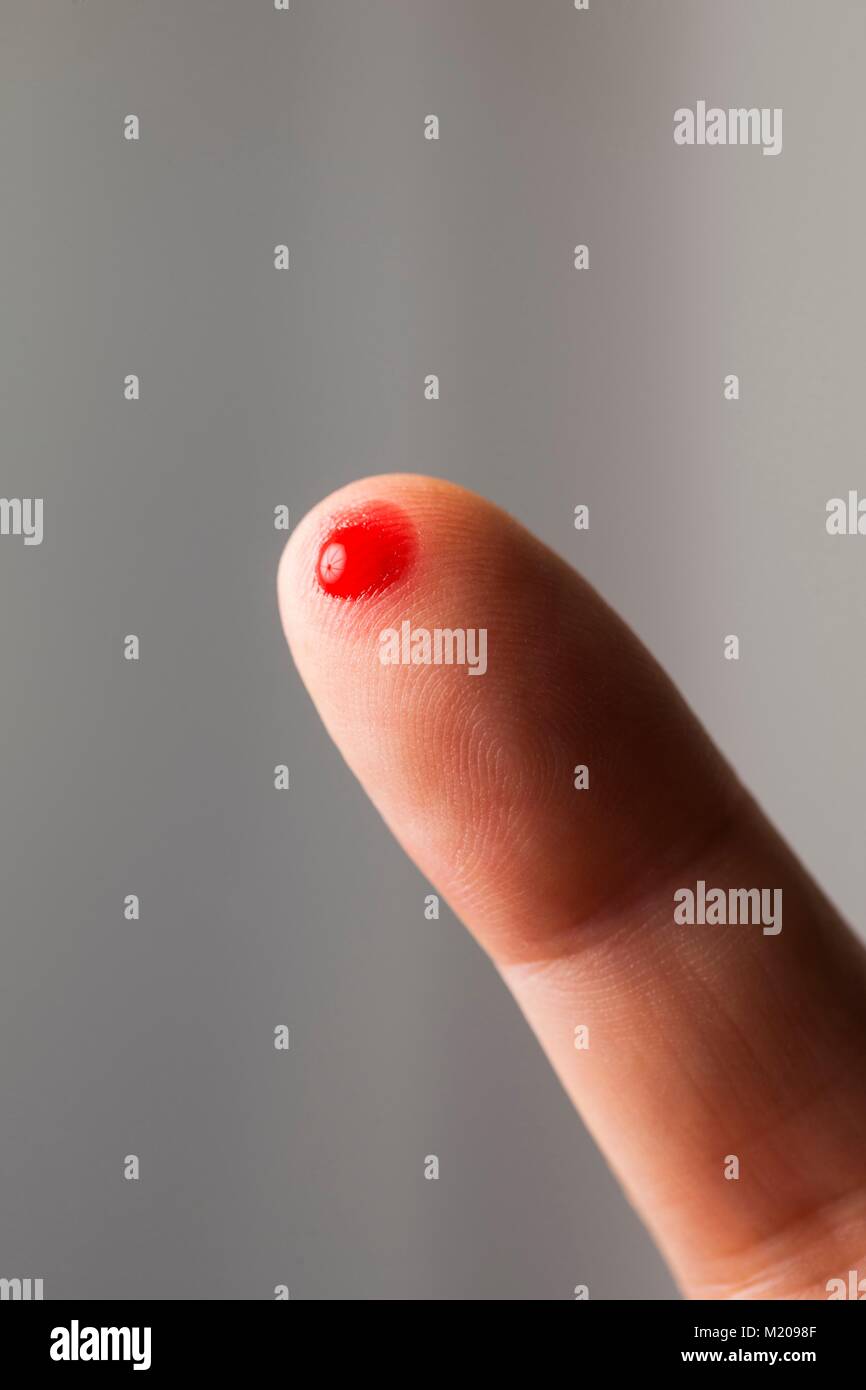 MODEL RELEASED. Blood on fingertip, close up Stock Photo - Alamy