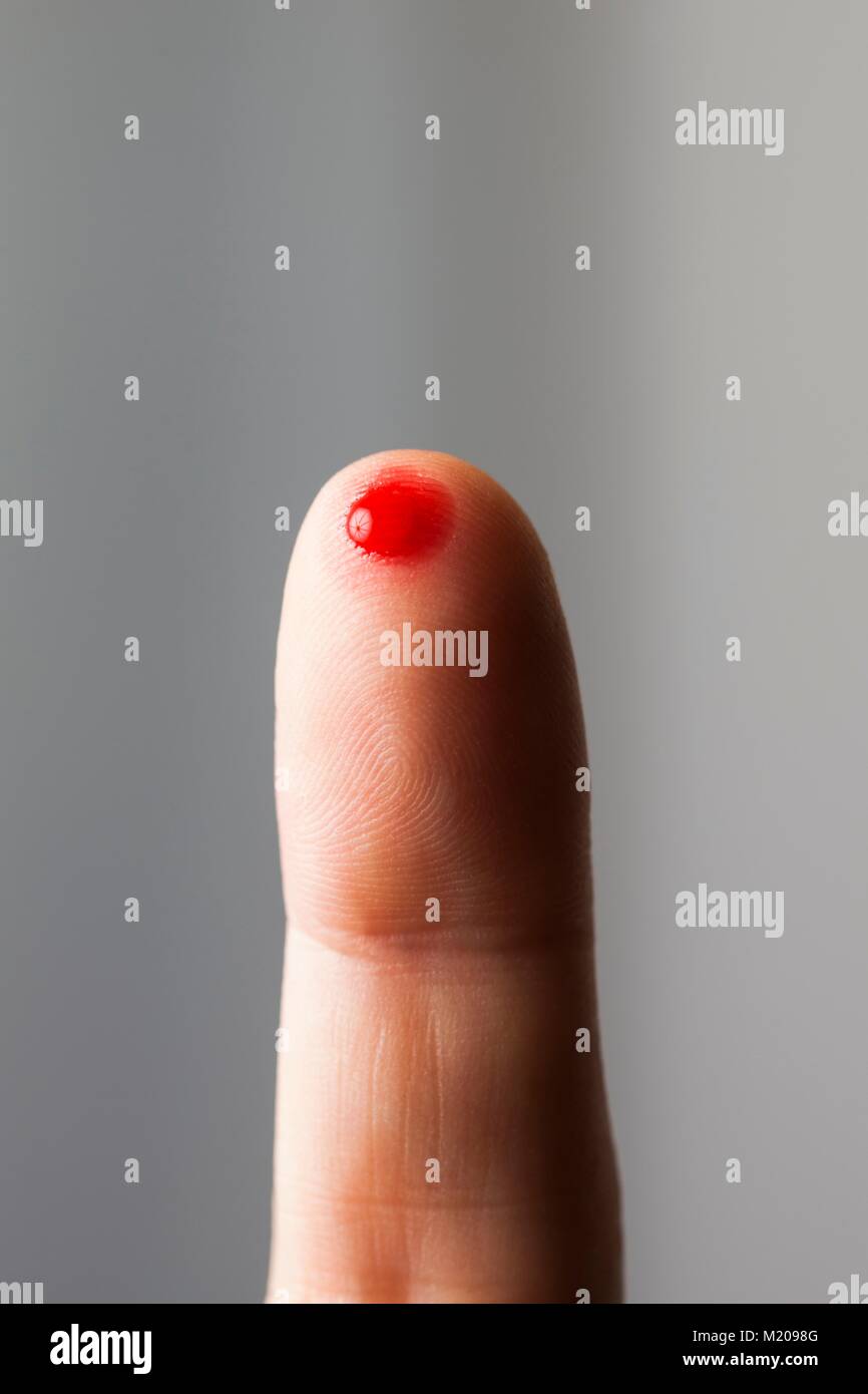 MODEL RELEASED. Blood on fingertip, close up Stock Photo - Alamy