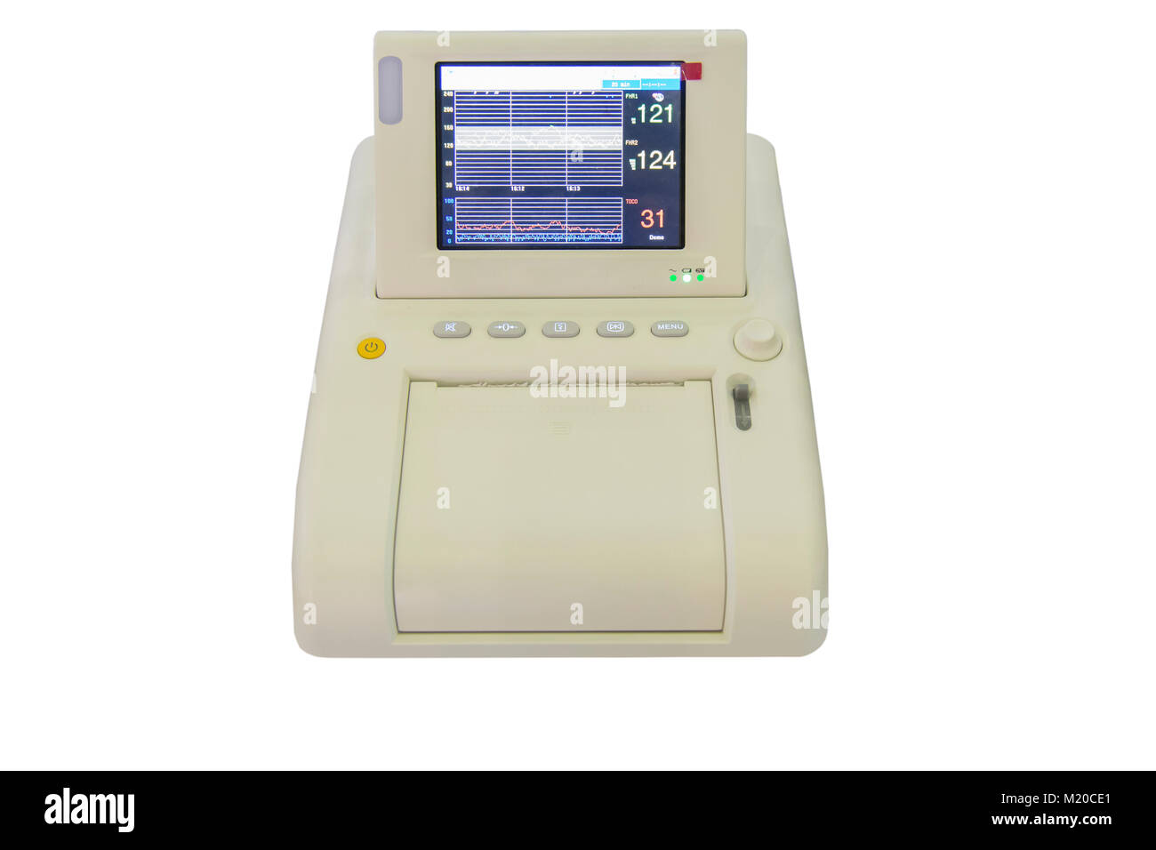 Non Stress Test Machine