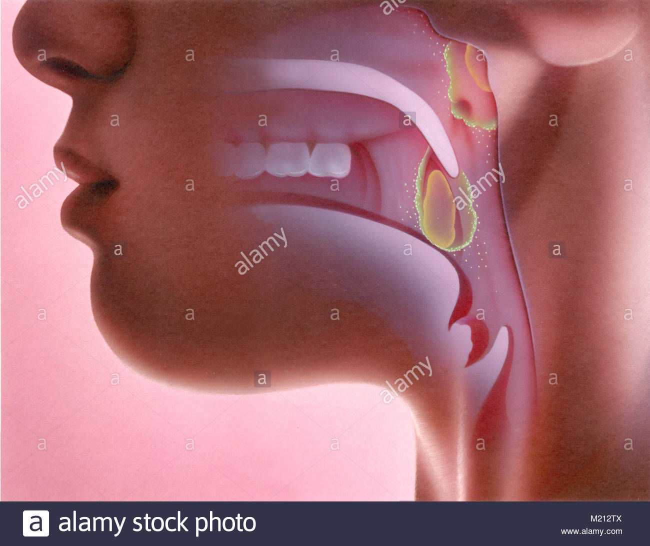 Cross Section Throat Stock Photos & Cross Section Throat Stock Images ...
