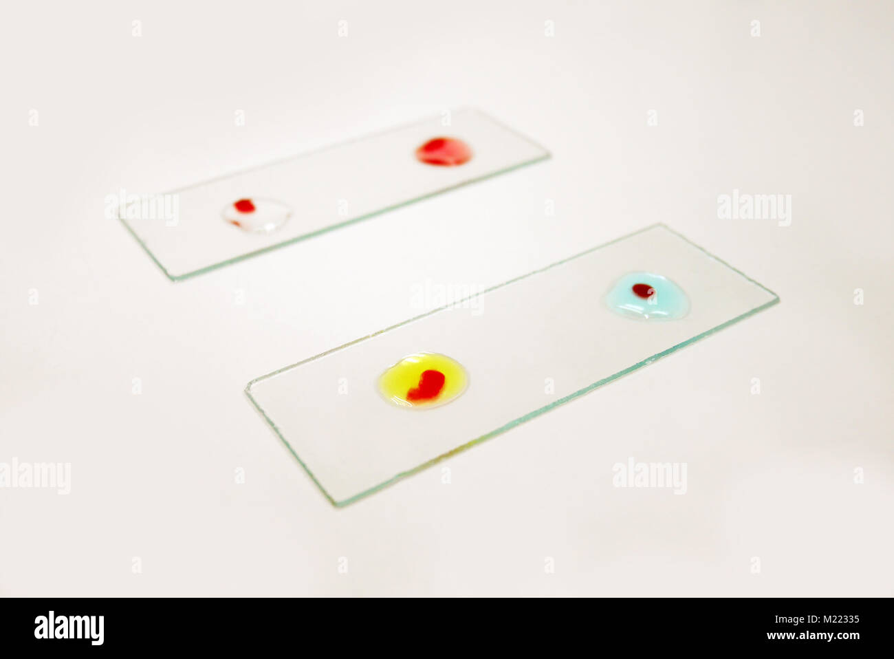 Blood group tasting of an O positive doner, with blood drop before ...