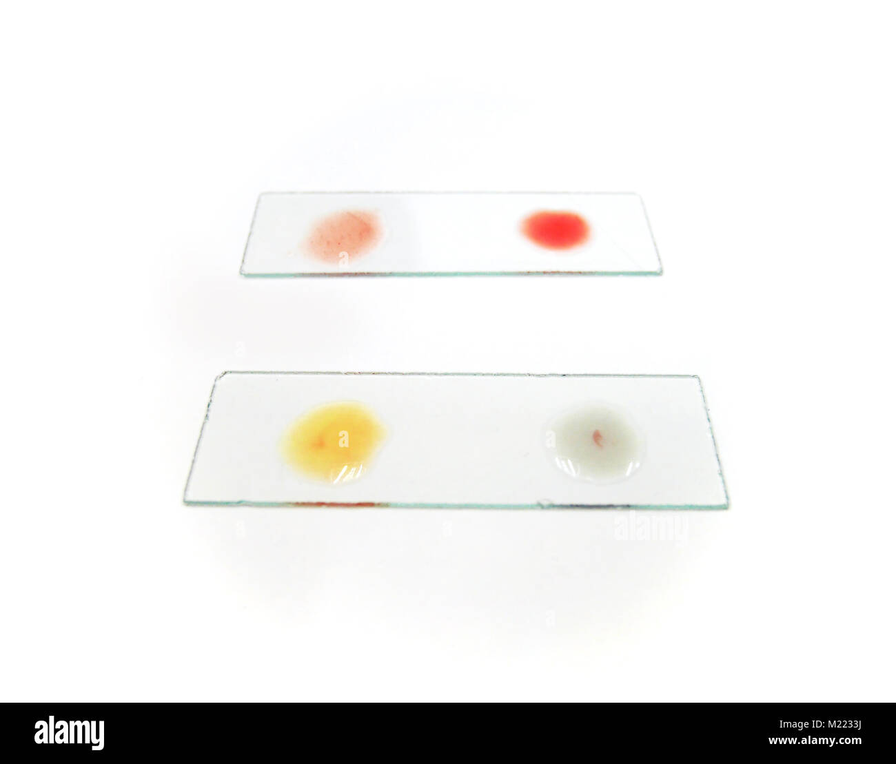Blood group slide Cut Out Stock Images & Pictures - Alamy