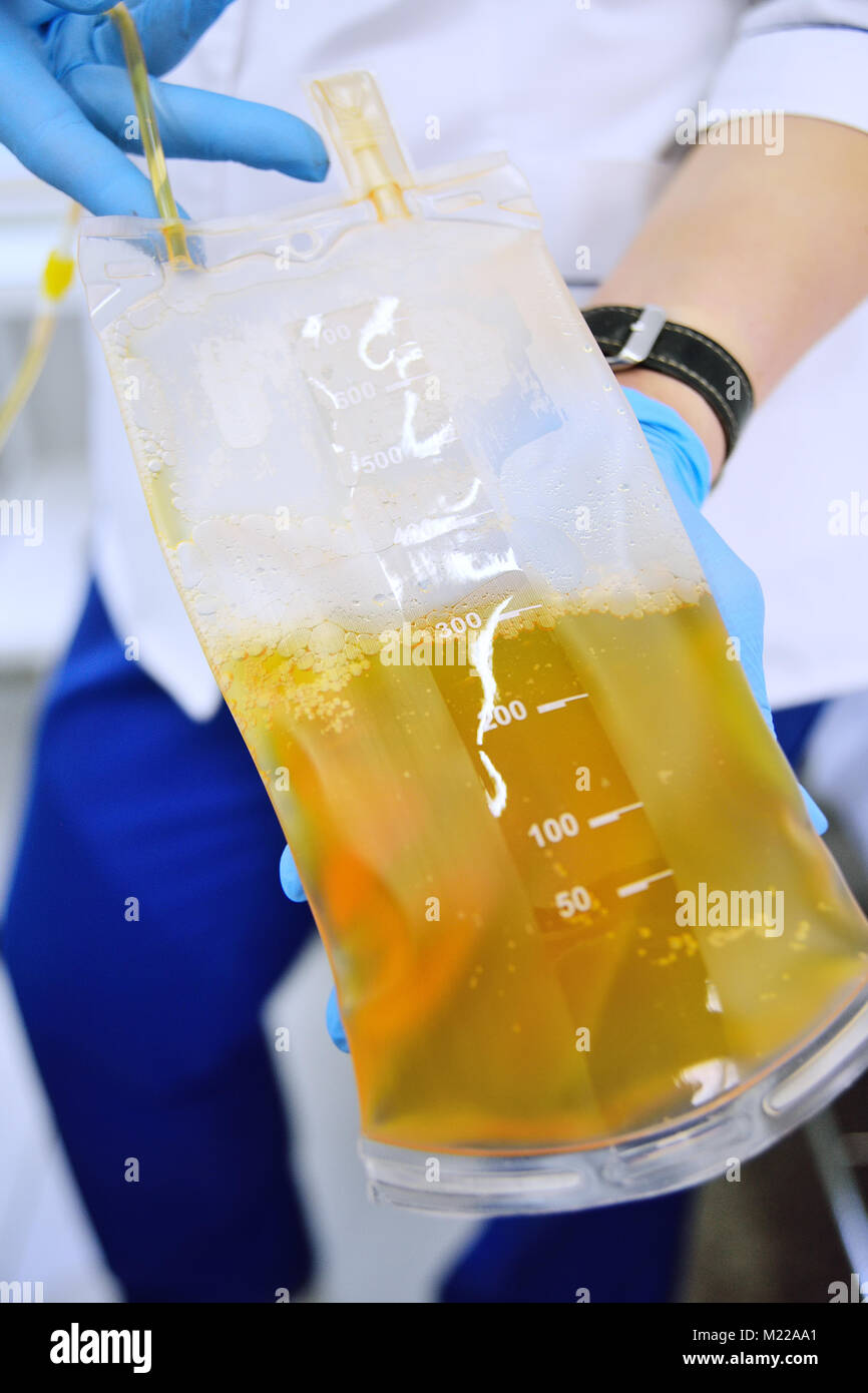 Blood plasma bag hi-res stock photography and images - Alamy