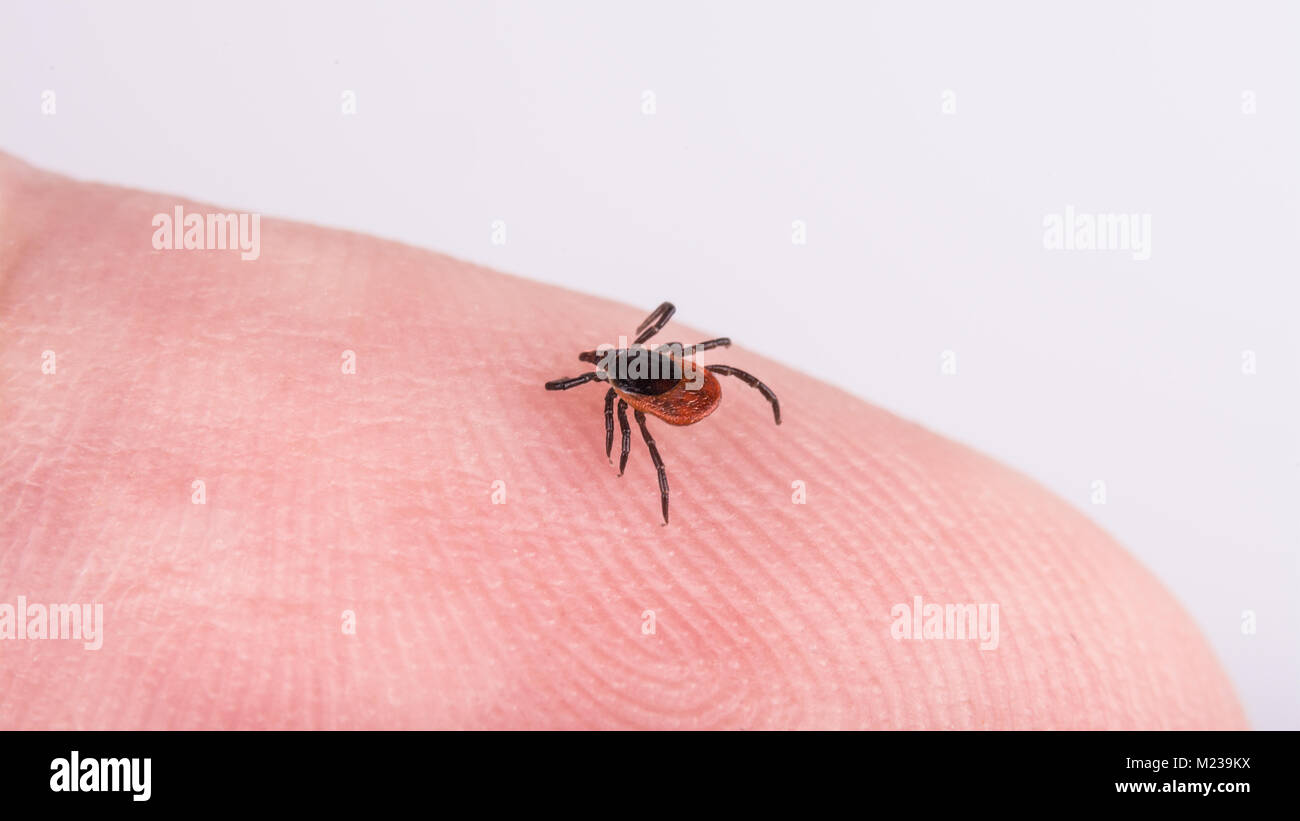 Parasitic mite infection of the skin hi-res stock photography and ...